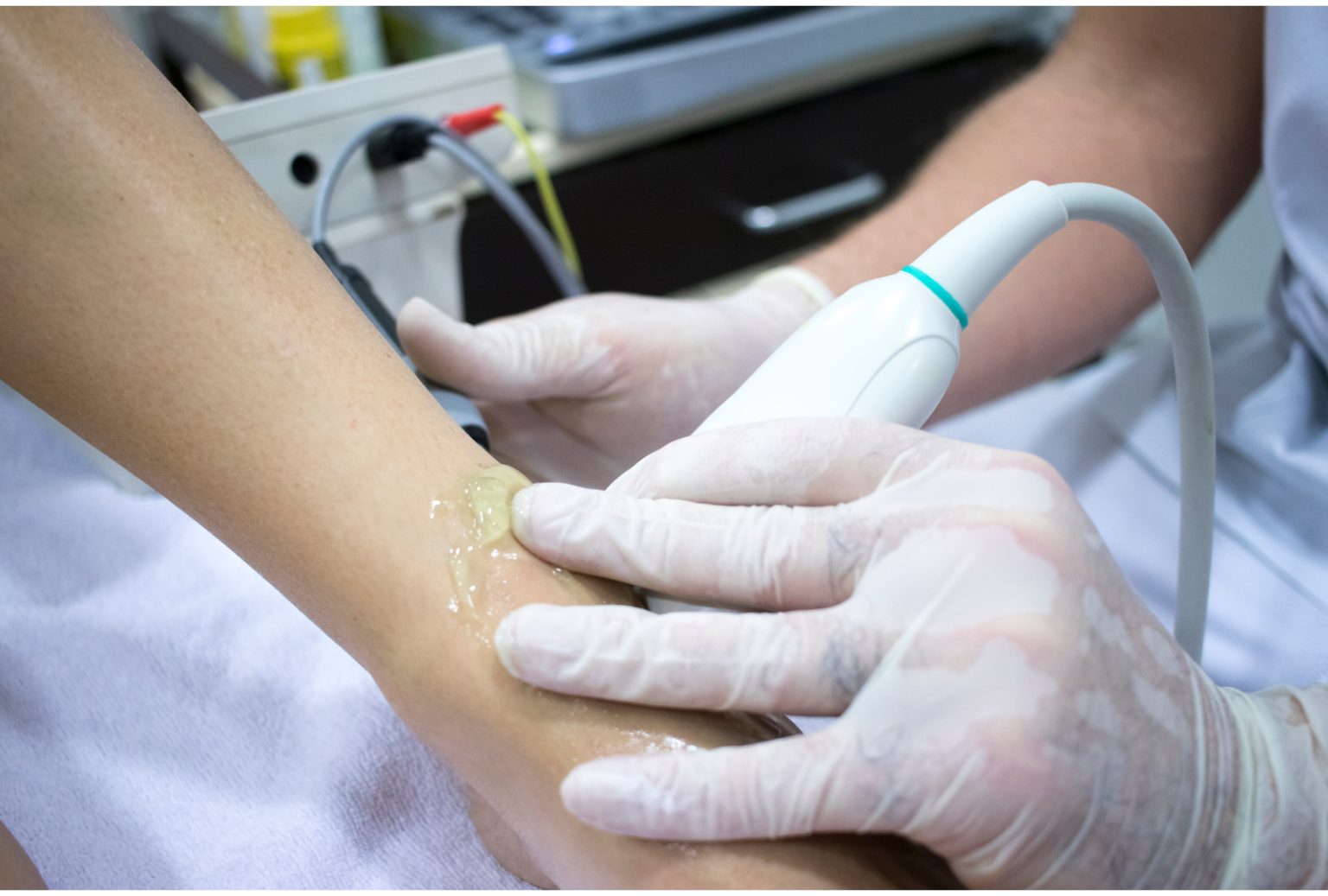 ¿Hay que hacer reposo después de la EPI? | Fisioterapia Aravaca